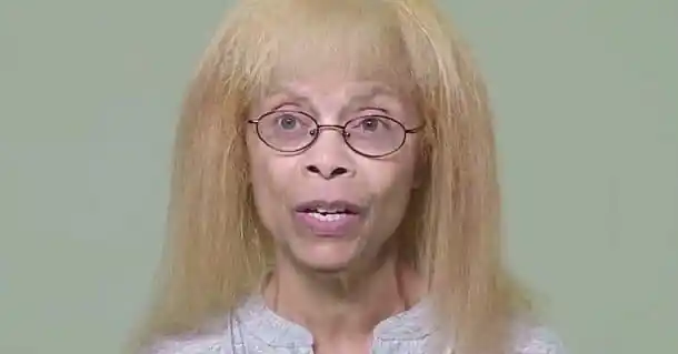 Terriblement complexée par son apparence physique, cette femme voulait ...